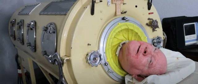 Muere Paul Alexander, el hombre que vivió 70 años con un pulmón de acero